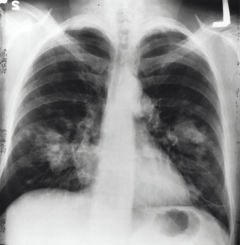 Free Arterial Blood Gas Interpreter Workbench: Acid-Base Disorder ...